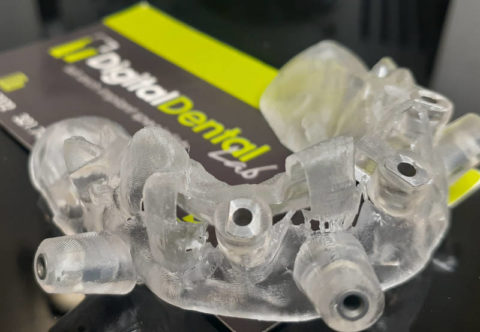 Surgical Guides - Digital Dental Lab